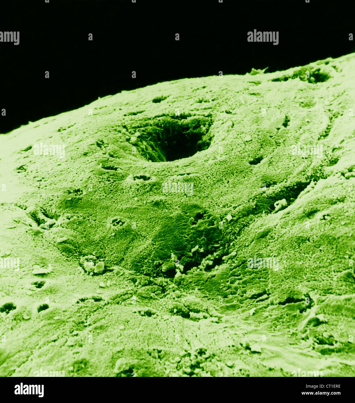 Colonic Glands High Resolution Stock Photography and Images - Alamy