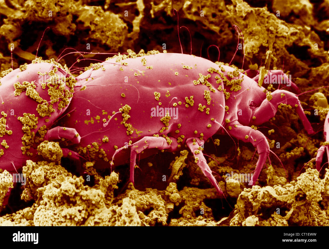 Dust mite microscope hi-res stock photography and images - Alamy
