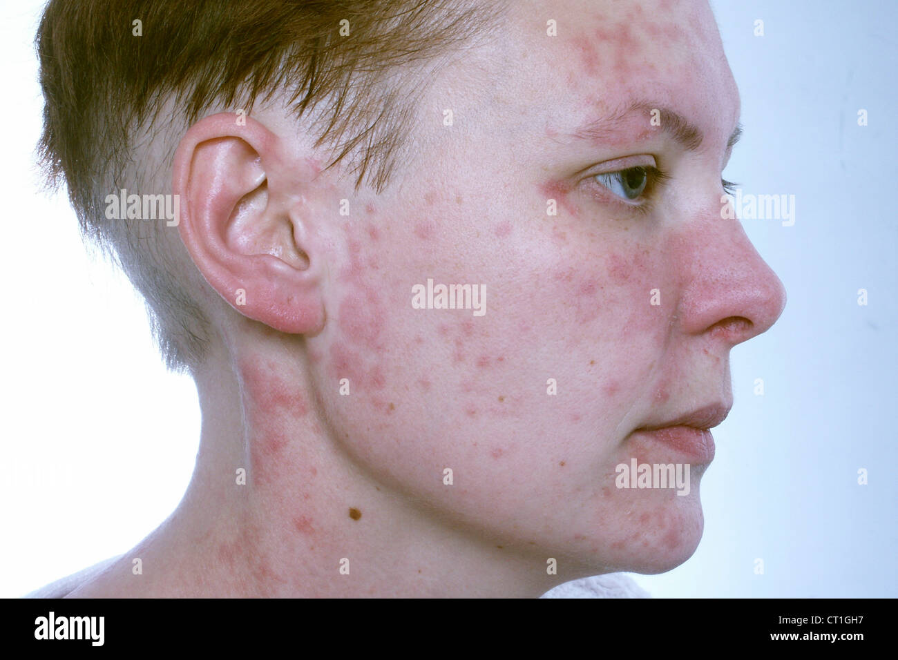 Poisonous skins hi-res stock photography and images - Alamy