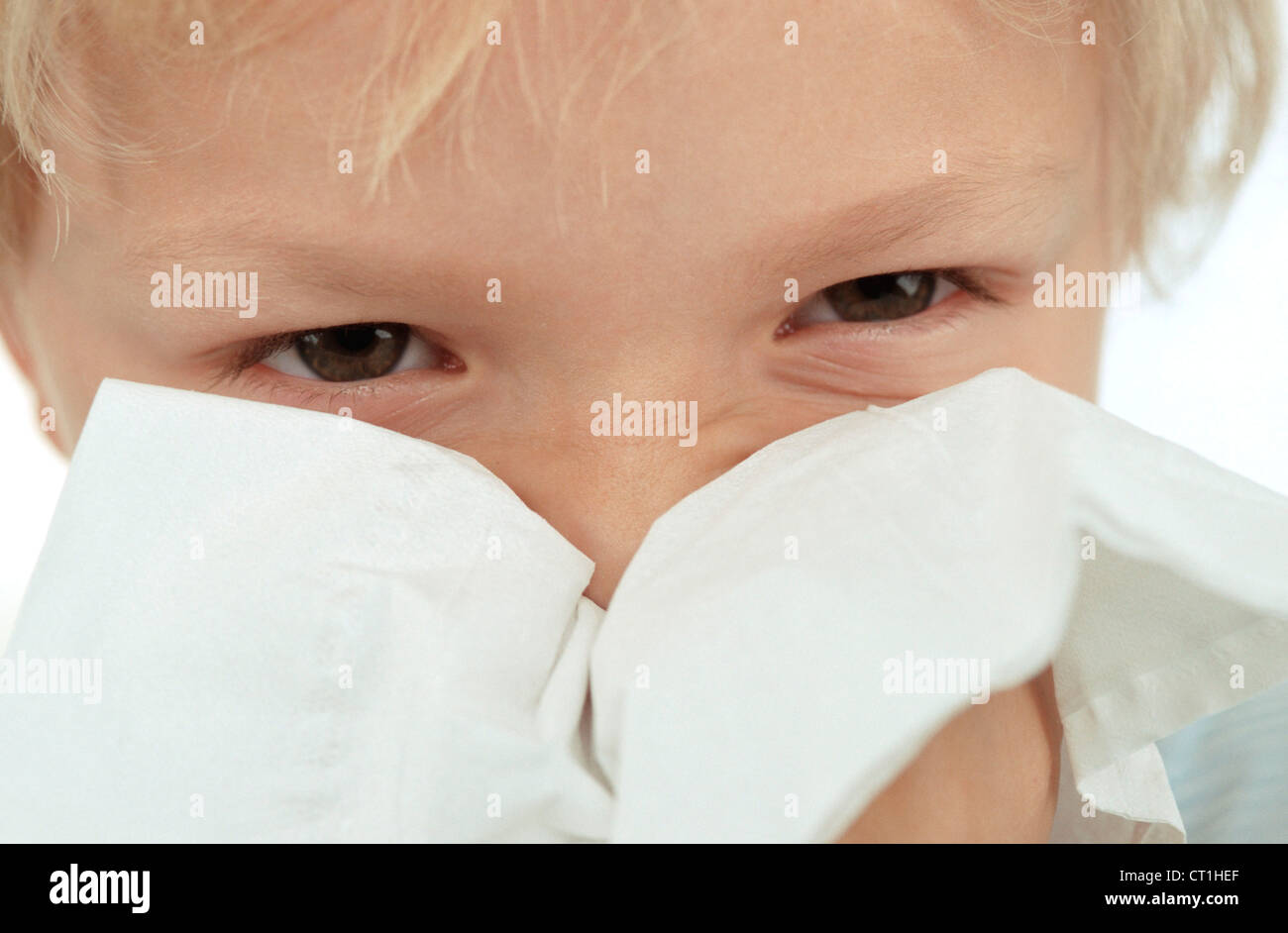 CHILD WITH RHINITIS Stock Photo - Alamy