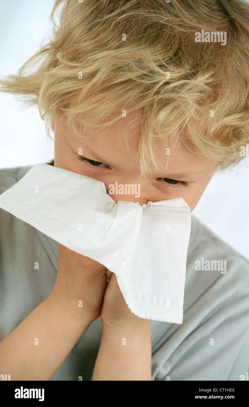 CHILD WITH RHINITIS Stock Photo - Alamy