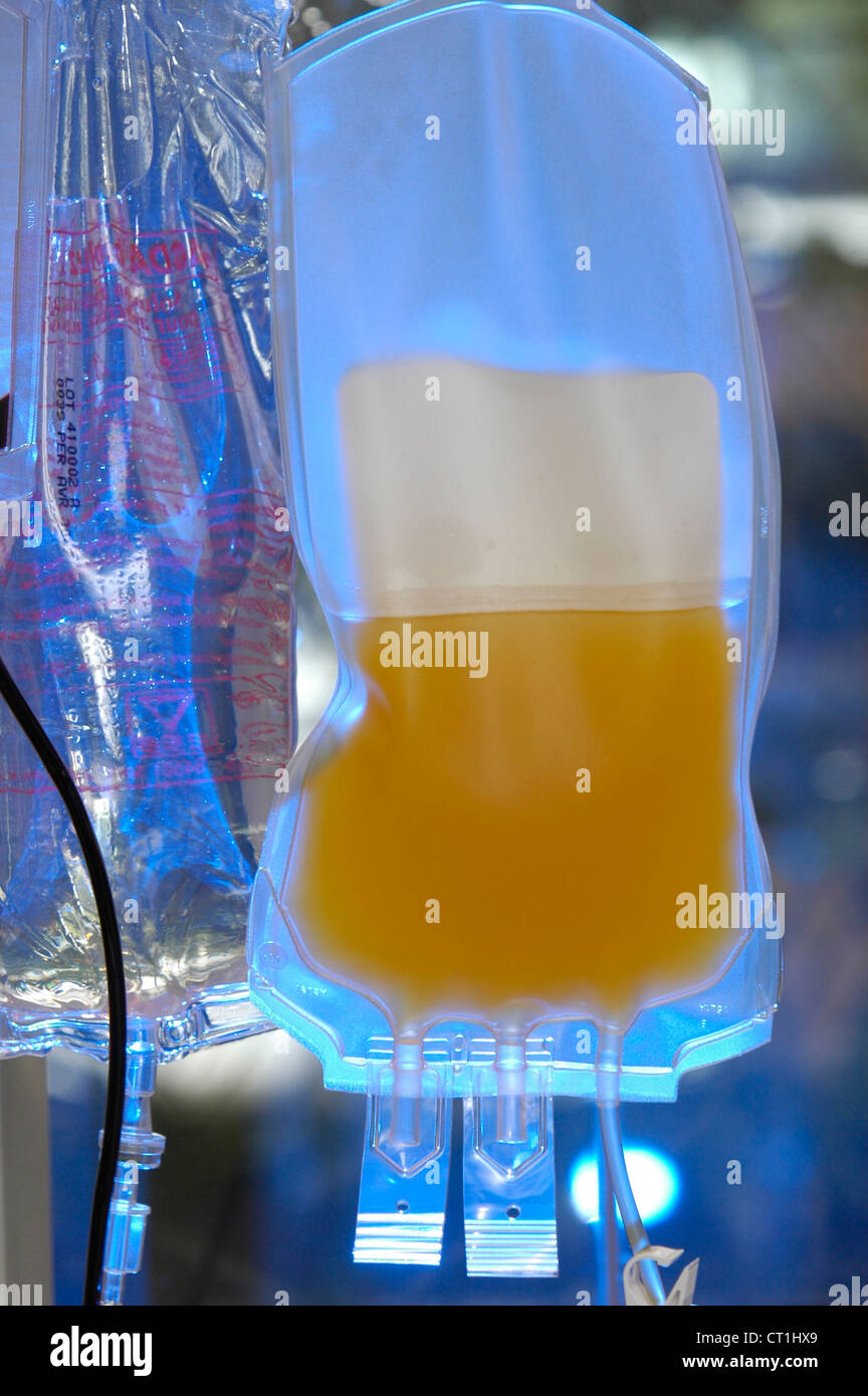 Plasma transfusions hi-res stock photography and images - Alamy