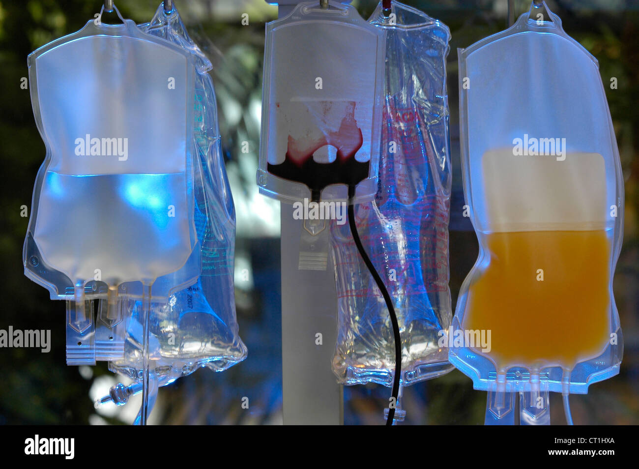 Plasma transfusions hi-res stock photography and images - Alamy