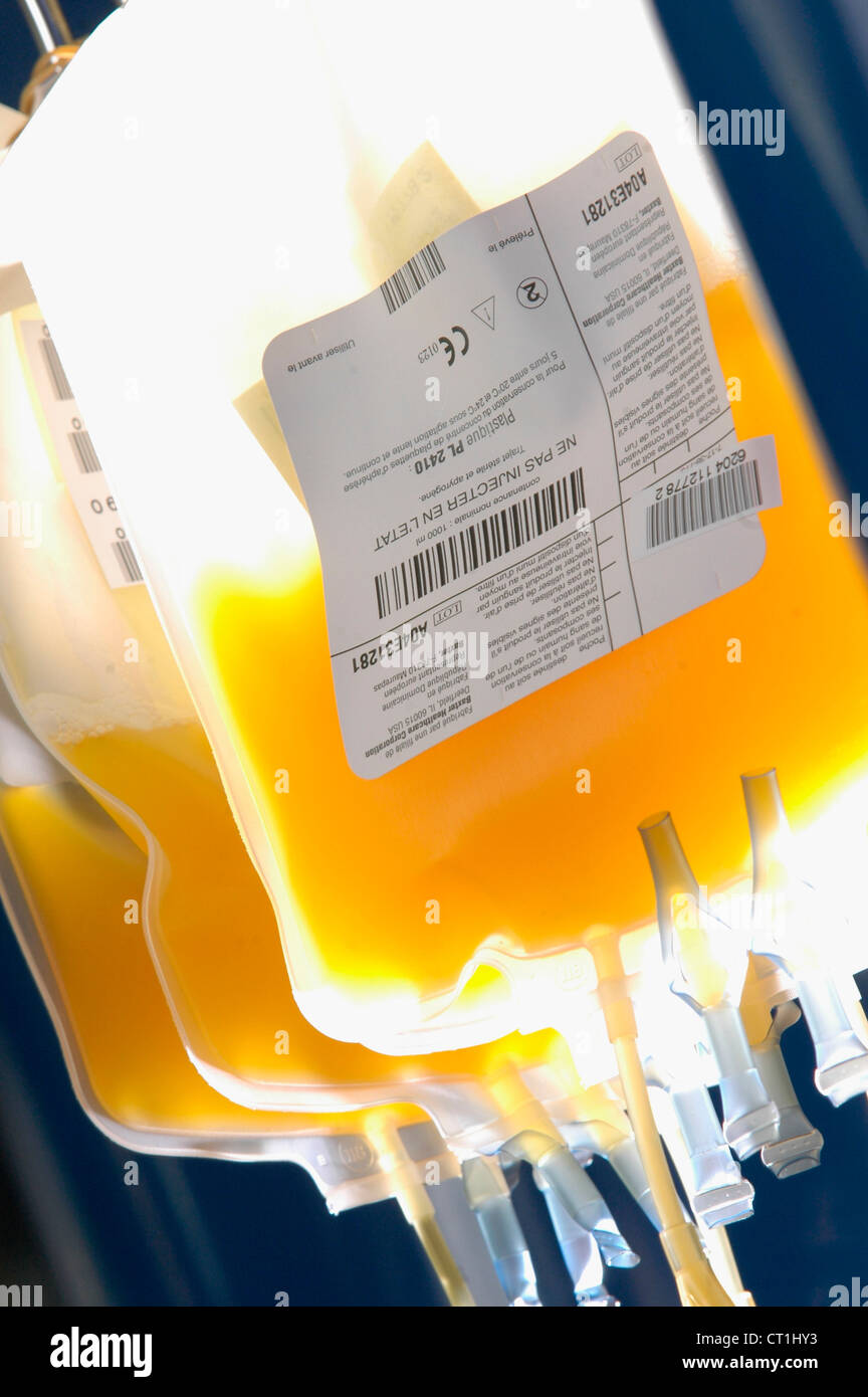 Platelet transfusion hi-res stock photography and images - Alamy