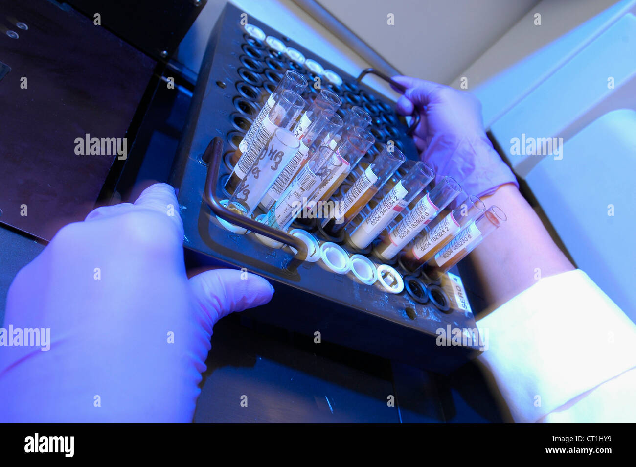 Automaton transfusion hi-res stock photography and images - Alamy