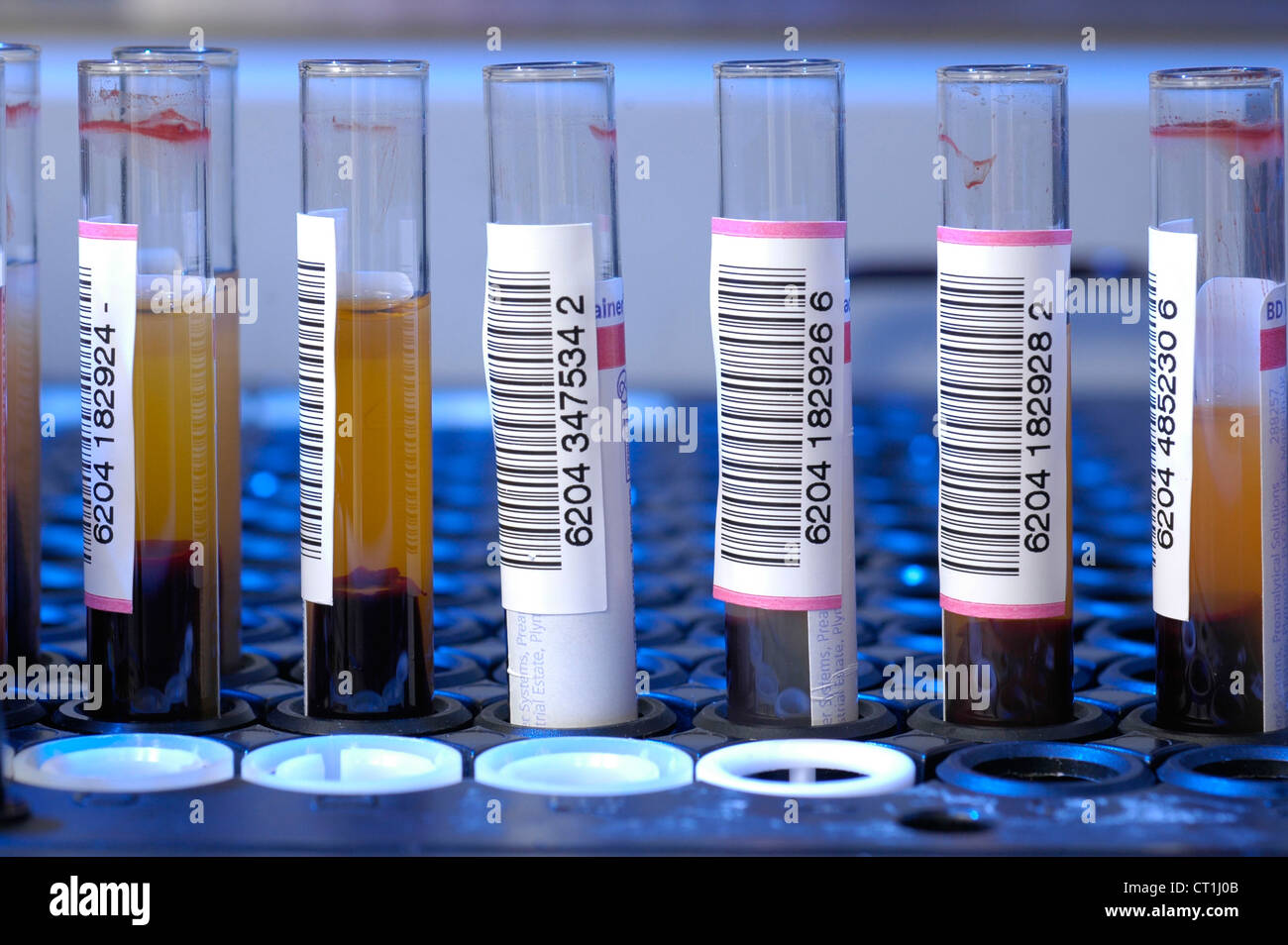 Hematology analyzers hi-res stock photography and images - Alamy