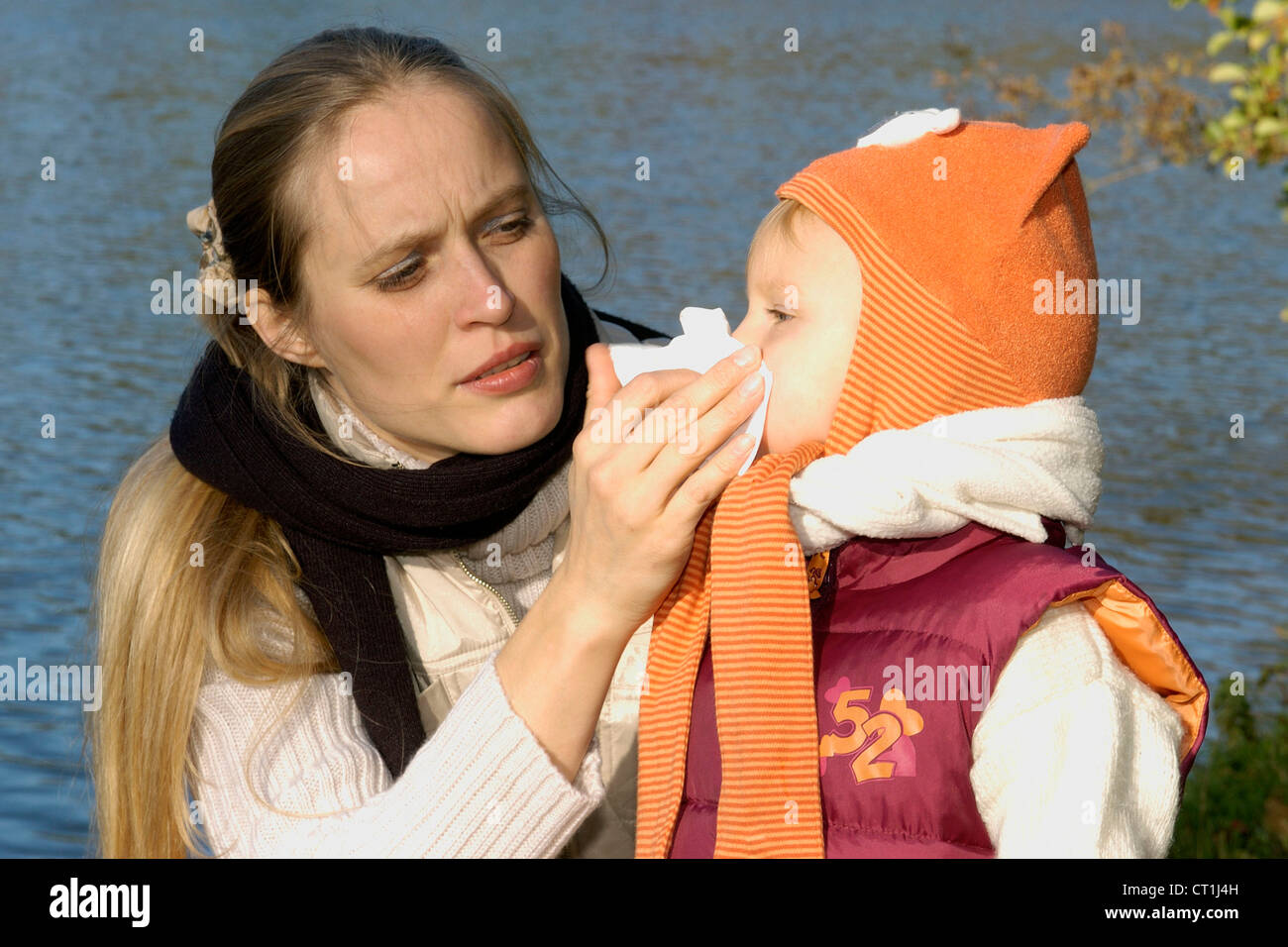 CHILD WITH RHINITIS Stock Photo - Alamy