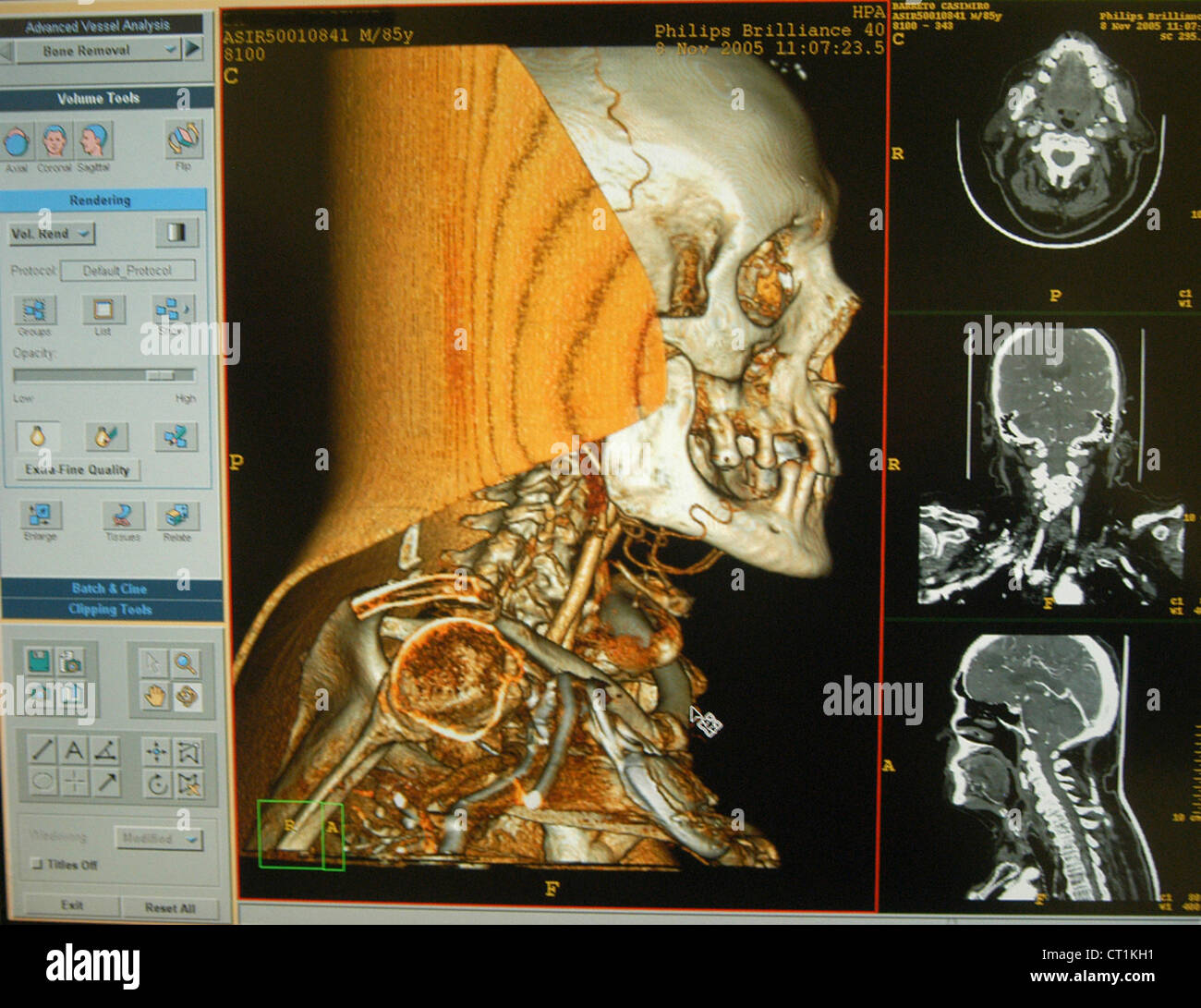 Ct 3 d scan hi-res stock photography and images - Alamy