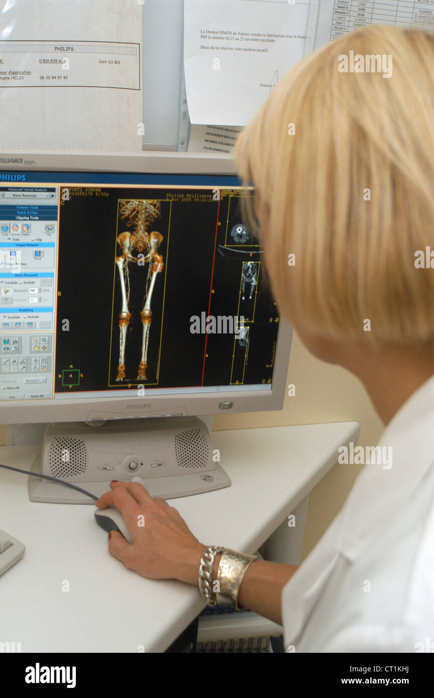 Ct Scan Leg Arteries Ct Scan Machine