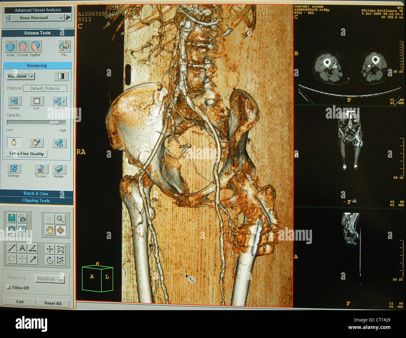 PELVIS, 3D SCAN Stock Photo - Alamy