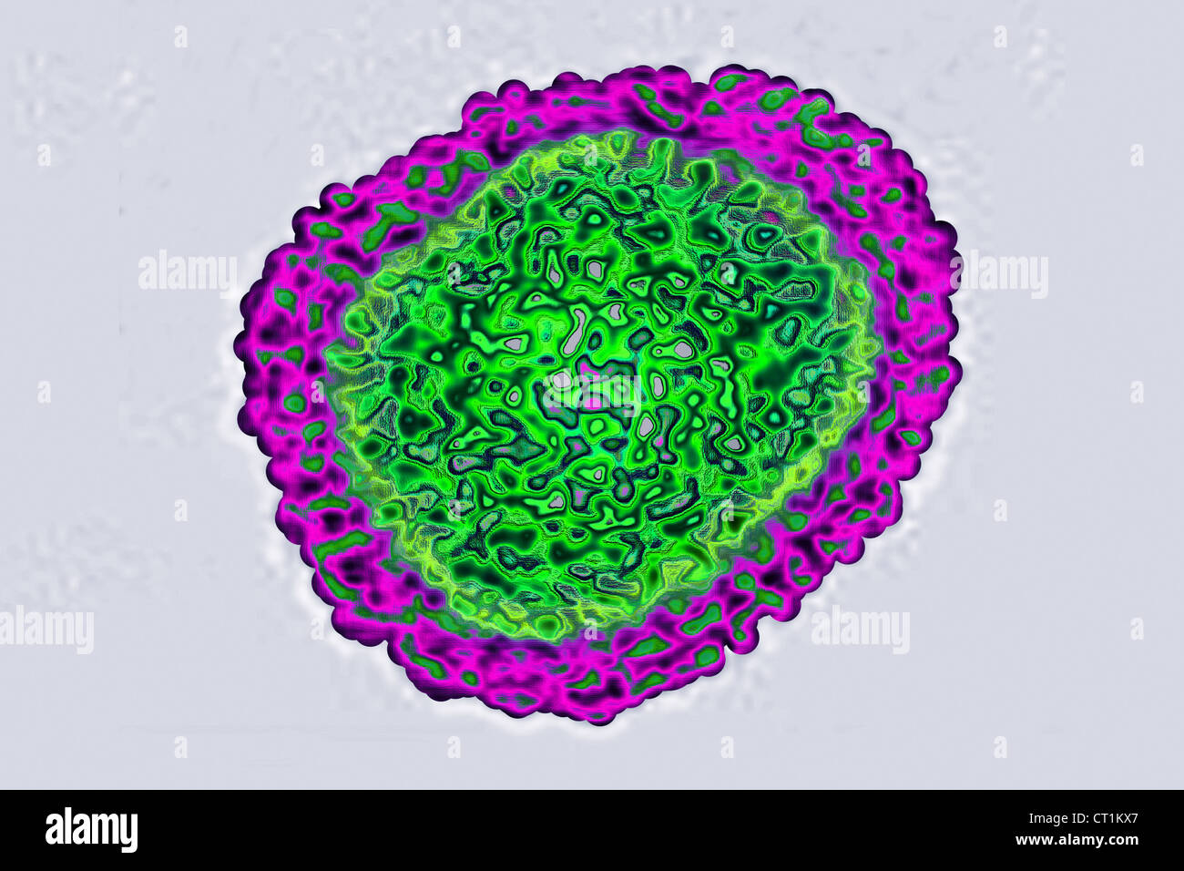 Avian influenza micrograph hi-res stock photography and images - Alamy