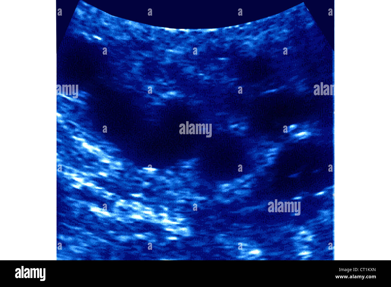 Testis examination hi-res stock photography and images - Alamy