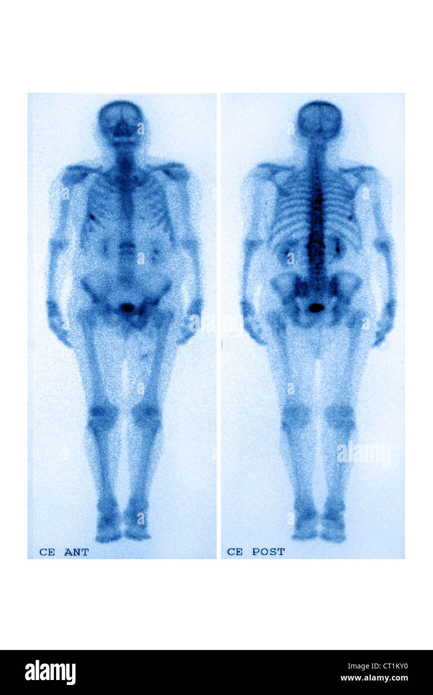 Scintiscanner result Cut Out Stock Images & Pictures - Alamy