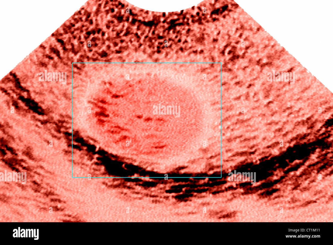 Red testicles hi-res stock photography and images - Alamy