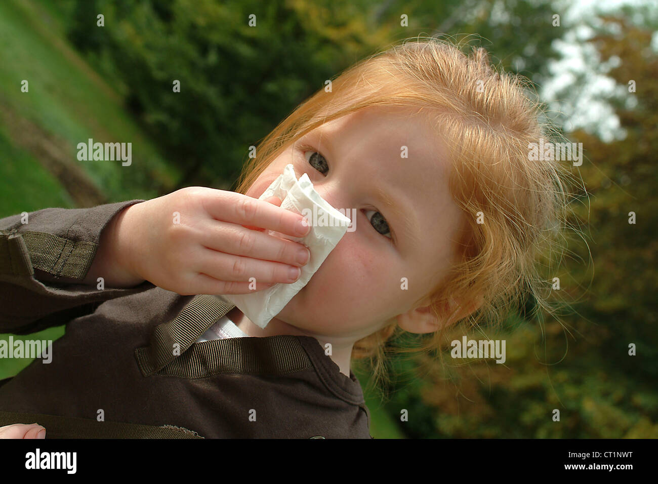 CHILD WITH RHINITIS Stock Photo - Alamy
