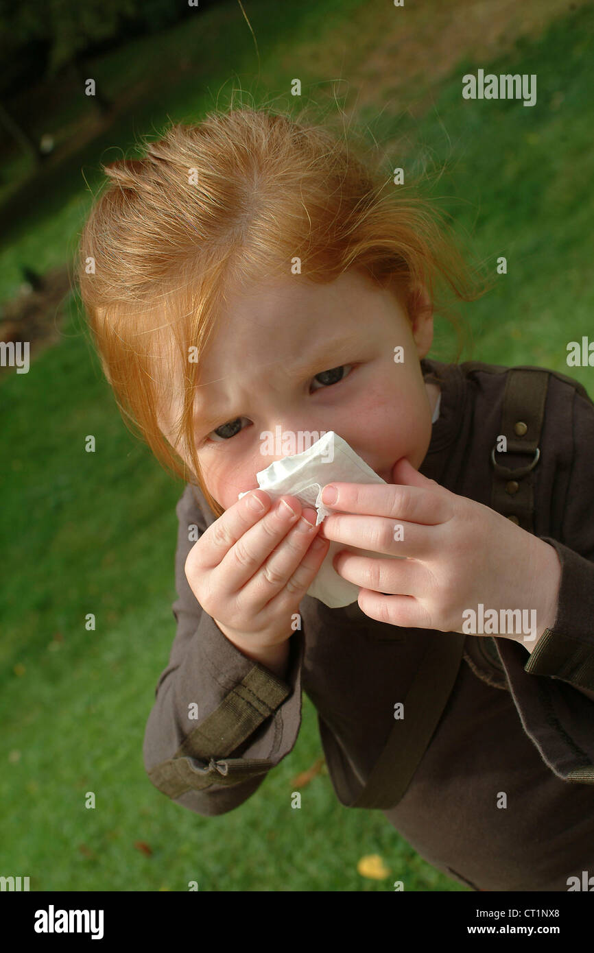 CHILD WITH RHINITIS Stock Photo - Alamy