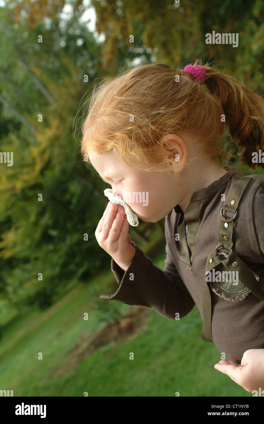 CHILD WITH RHINITIS Stock Photo - Alamy