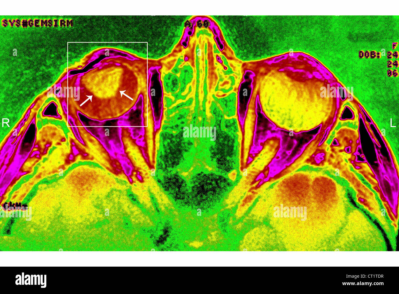 Test detachment hi-res stock photography and images - Alamy