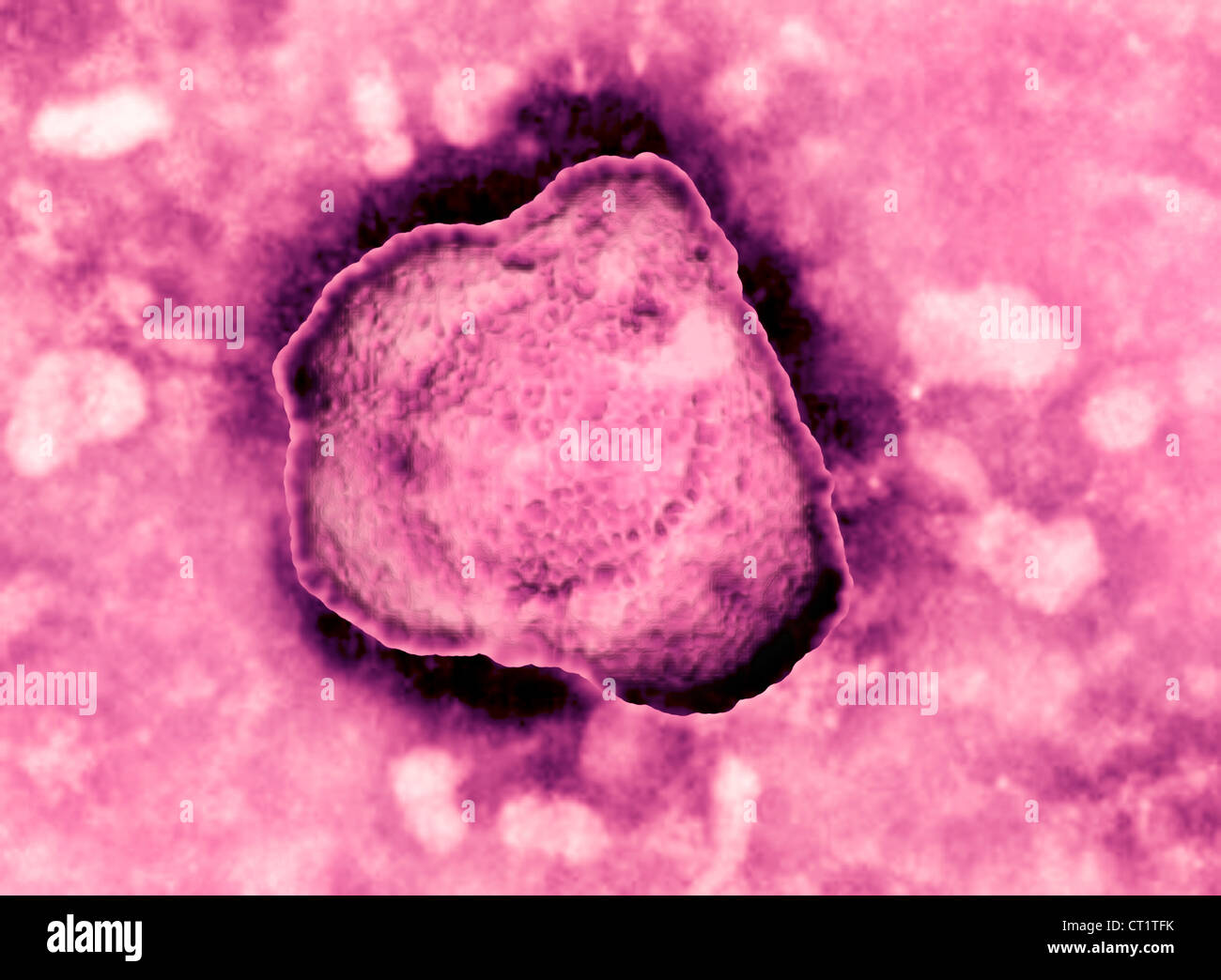 Electron microscope micrograph herpes hi-res stock photography and ...