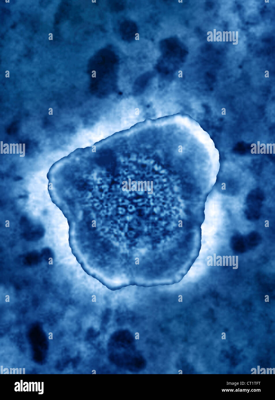 HERPES SIMPLEX VIRUS Stock Photo - Alamy