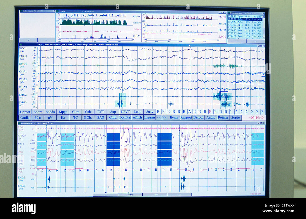 Eeg sleep hi-res stock photography and images - Alamy