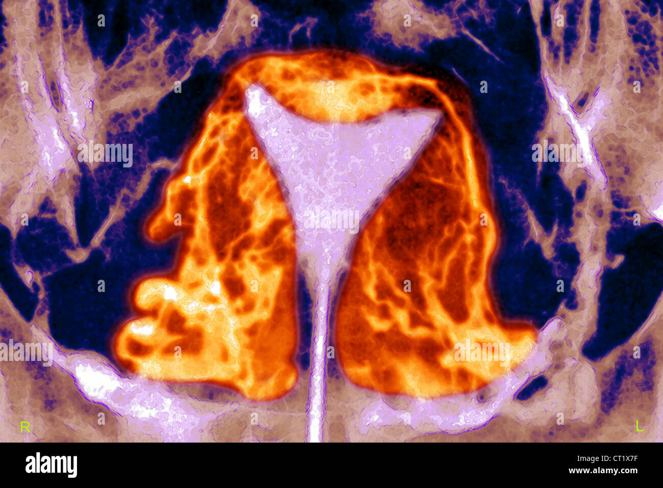 Hysterography hi-res stock photography and images - Alamy