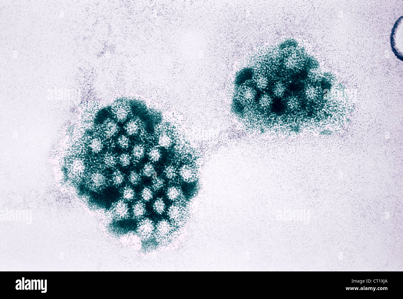 Norwalk viruses hi-res stock photography and images - Alamy