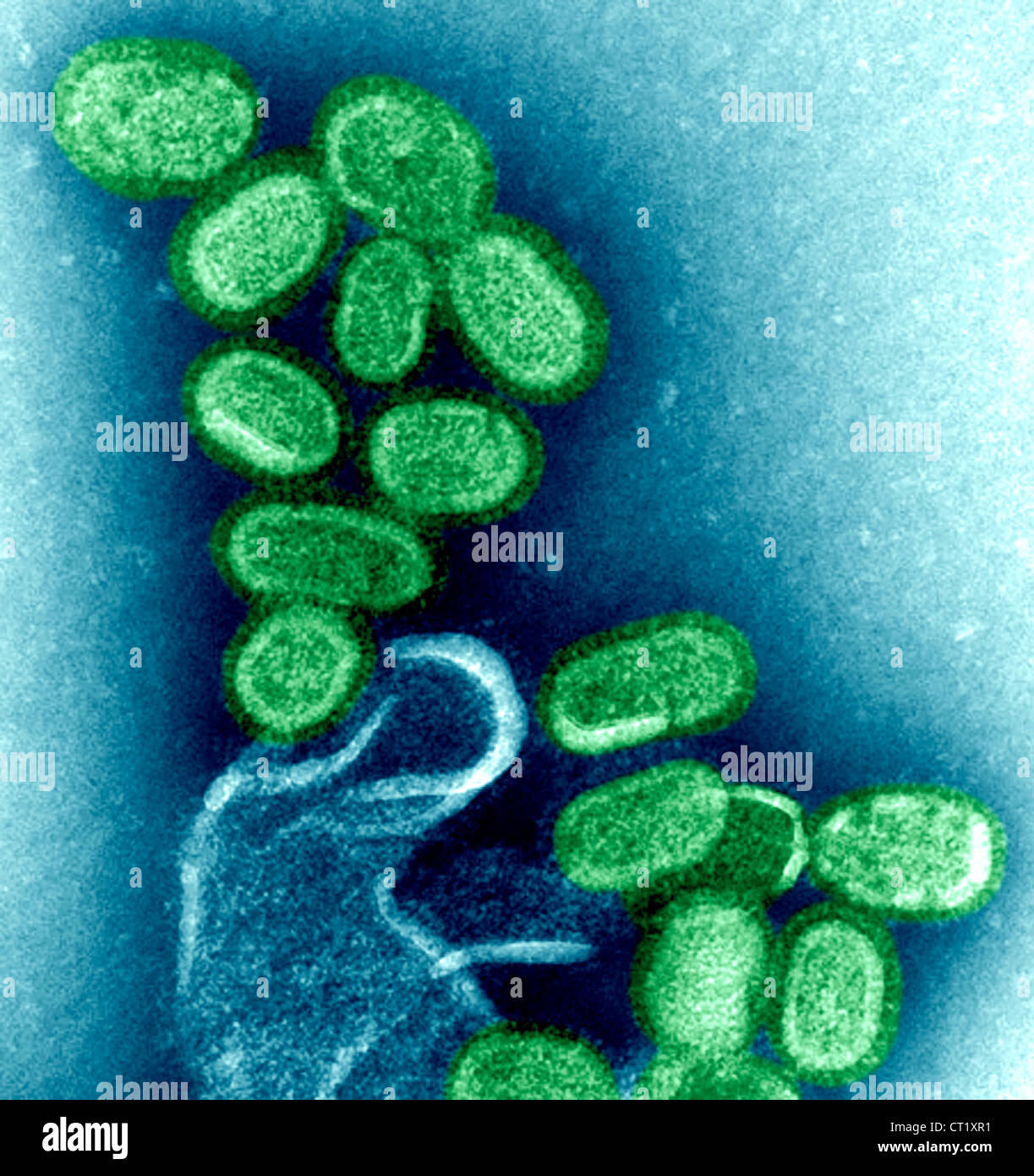 SPANISH FLU INFECTION Stock Photo - Alamy