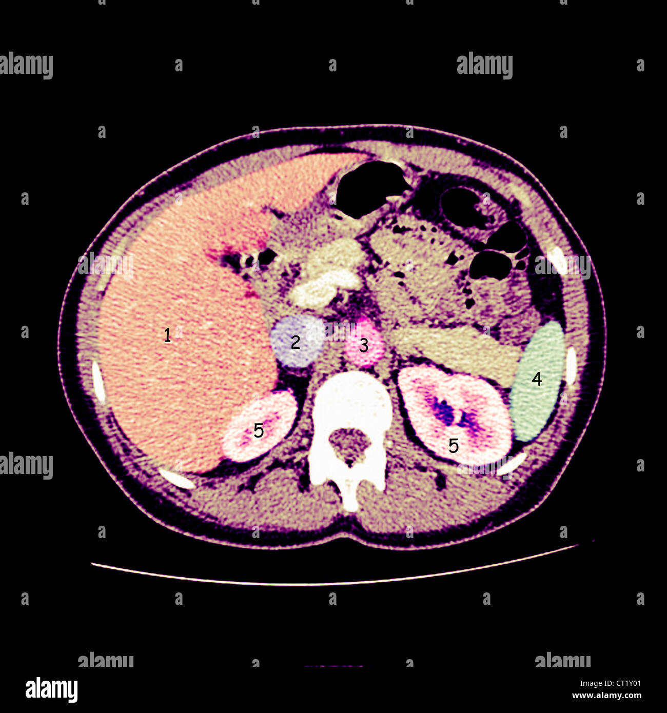 Normal liver scan hi-res stock photography and images - Alamy