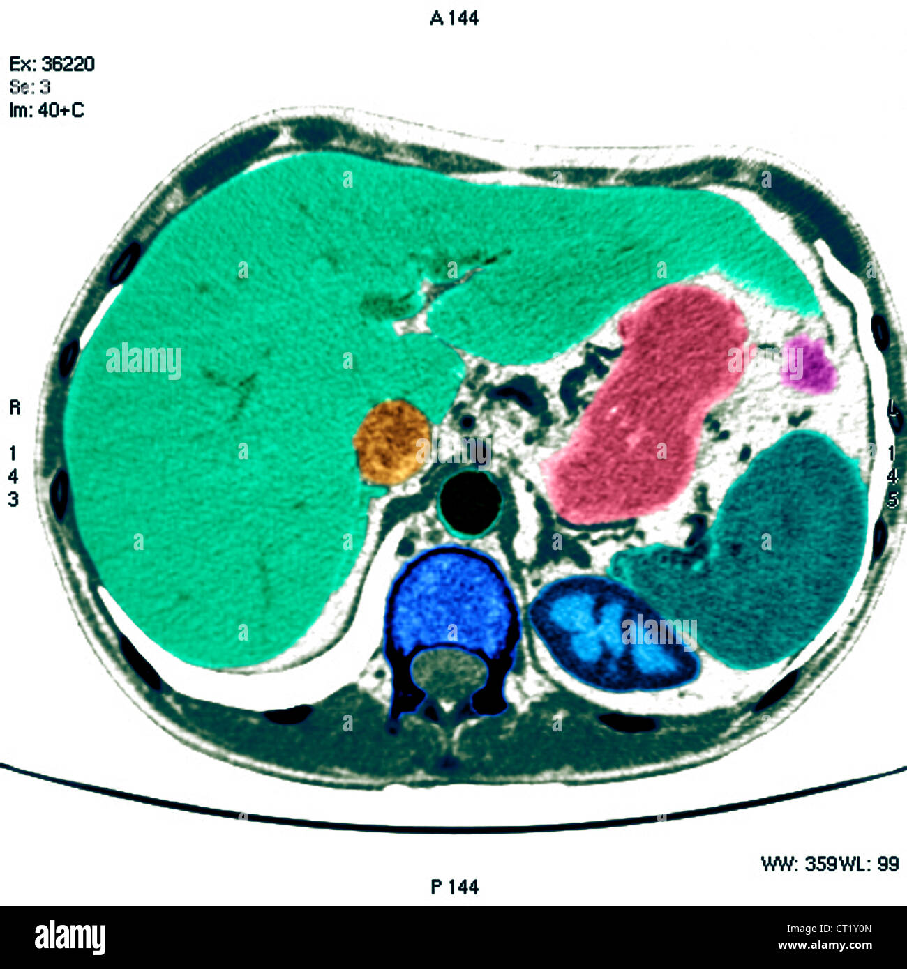 Liver Scan High Resolution Stock Photography and Images - Alamy