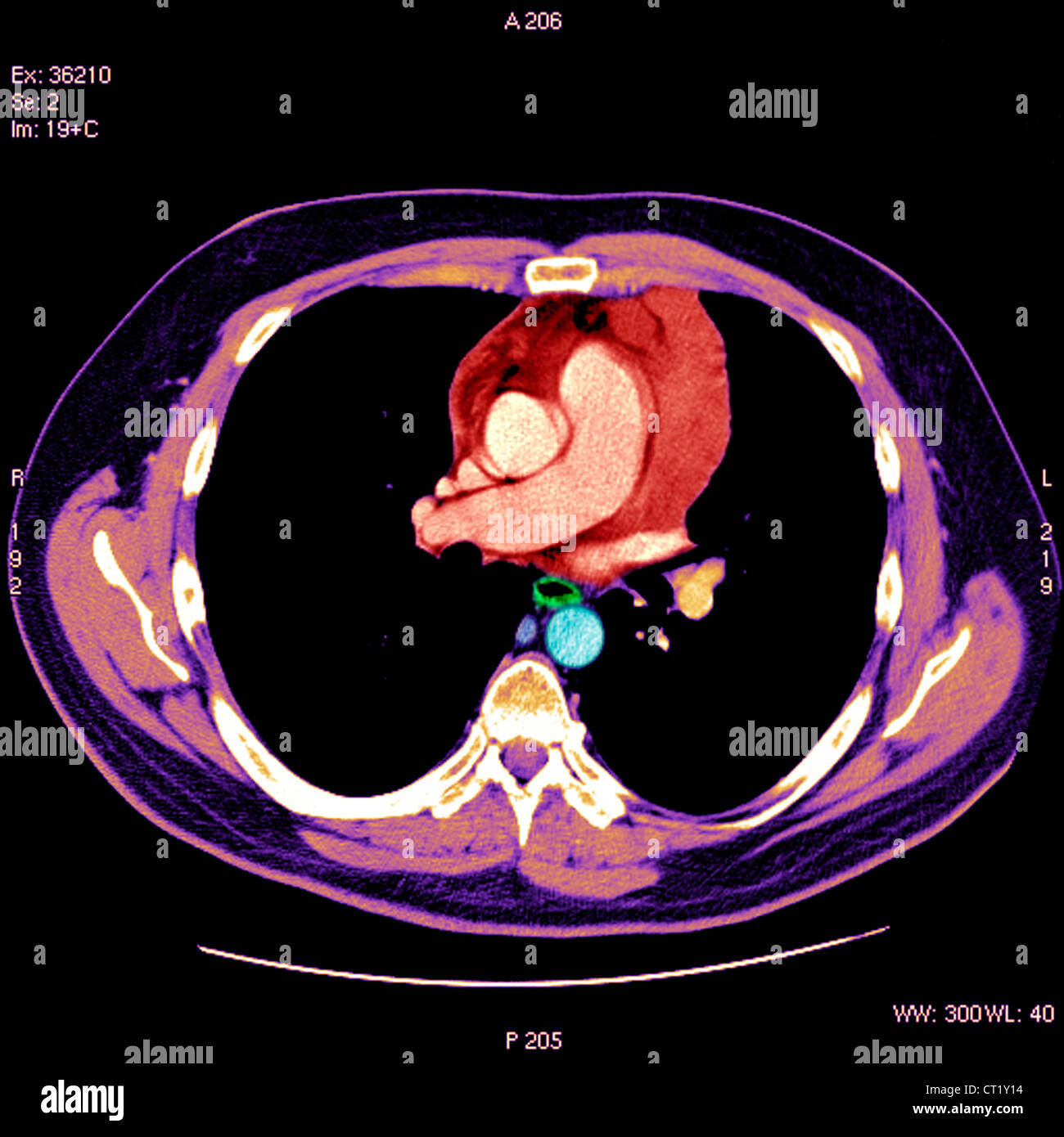 Heart scan hi-res stock photography and images - Alamy