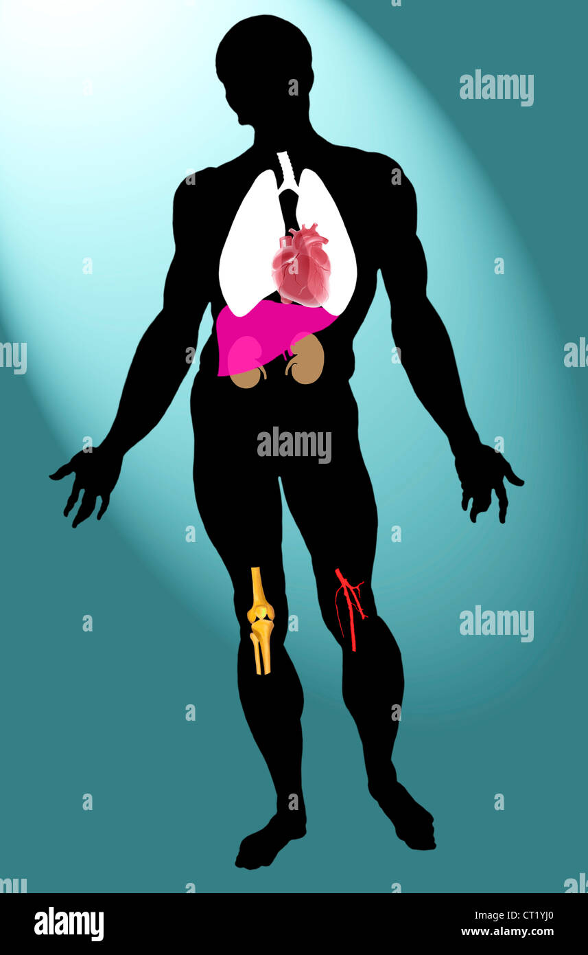 Lung transplant hi-res stock photography and images - Alamy