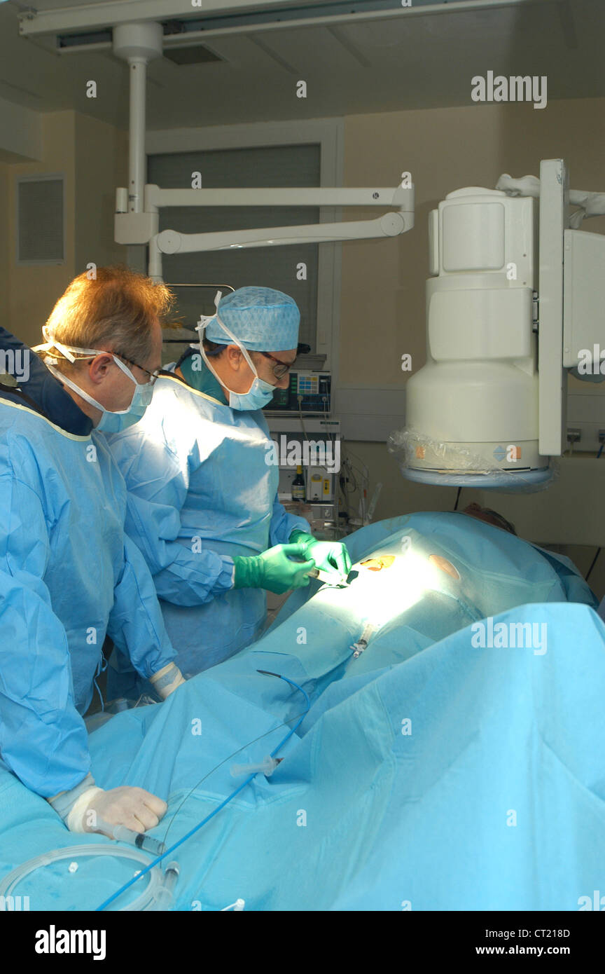 Digital angiography hi-res stock photography and images - Alamy