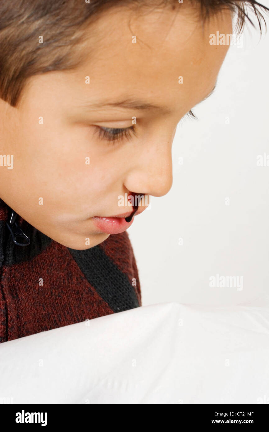 Boy bleeding nose hi-res stock photography and images - Alamy