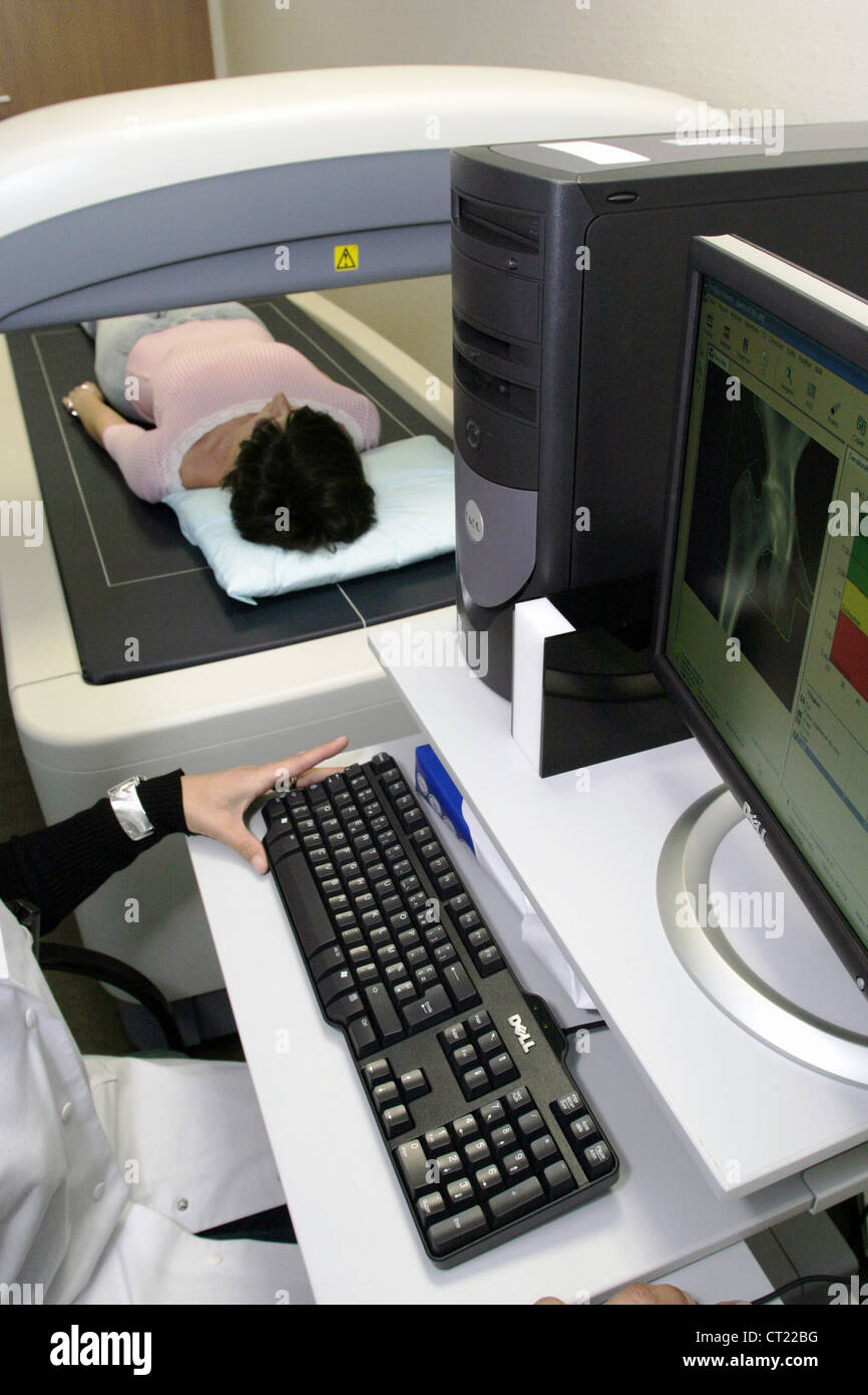 Bone density results hi-res stock photography and images - Alamy