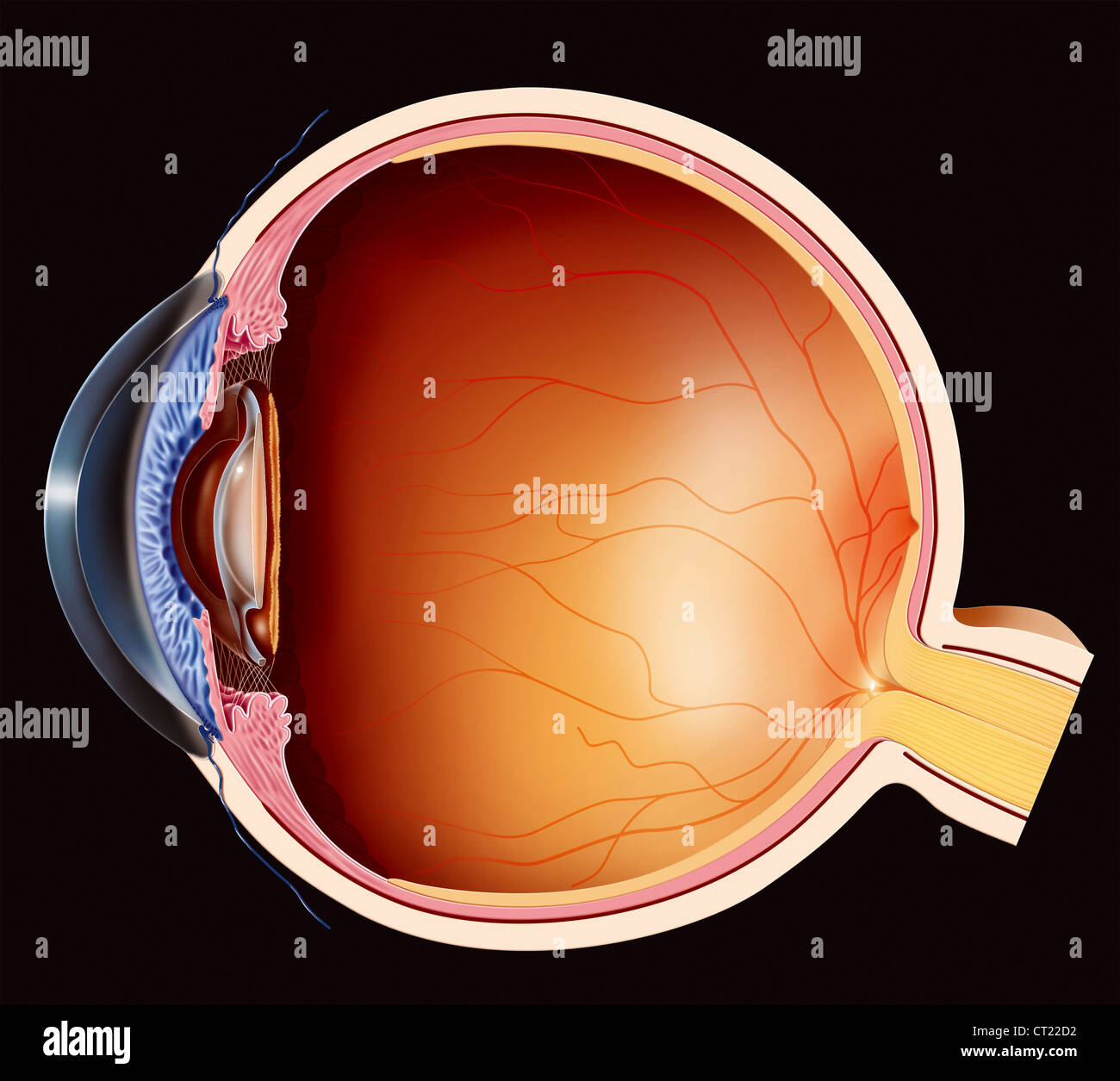 Posterior subcapsular cataract hi-res stock photography and images - Alamy