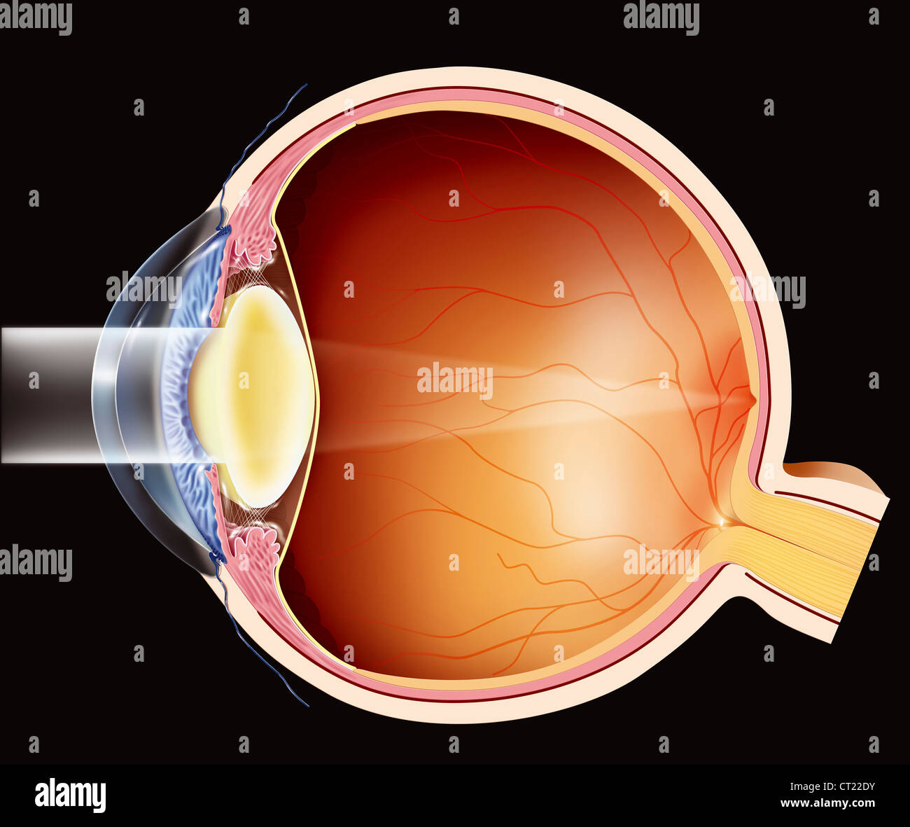 Total cataract hi-res stock photography and images - Alamy