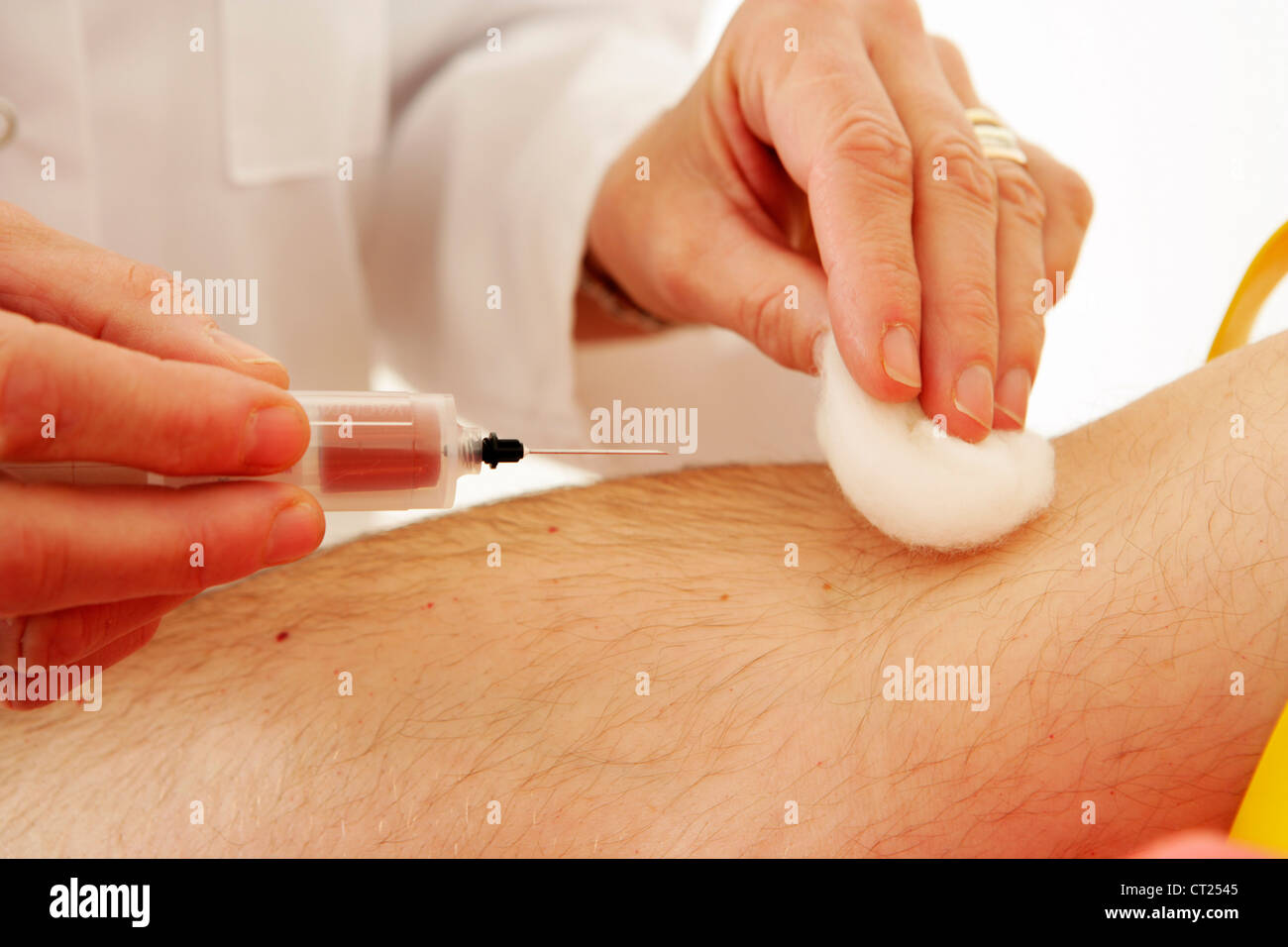 BLOOD SPECIMEN IN A MAN Stock Photo - Alamy