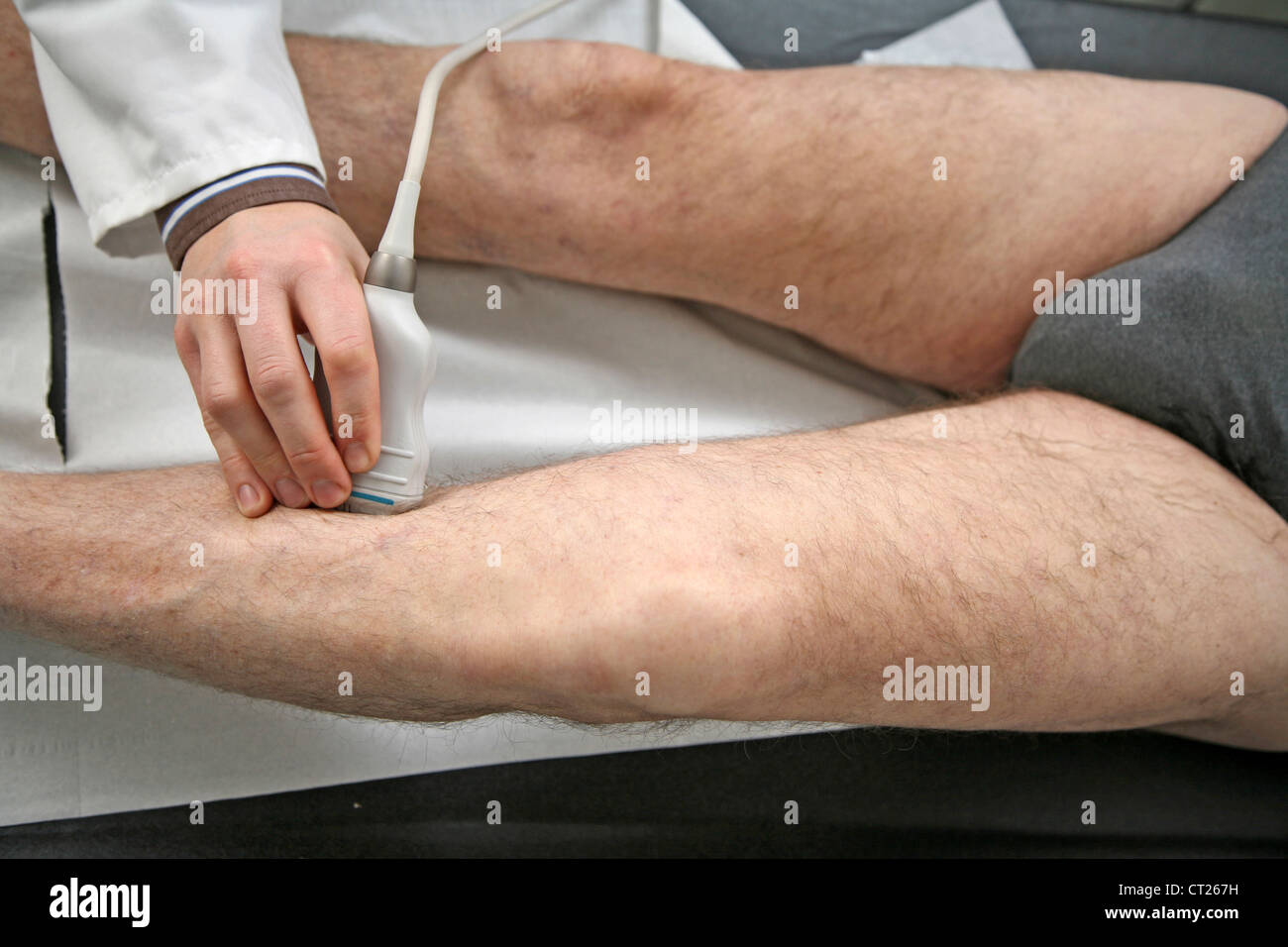 TIBIAL ARTERY, DOPPLER TEST Stock Photo - Alamy