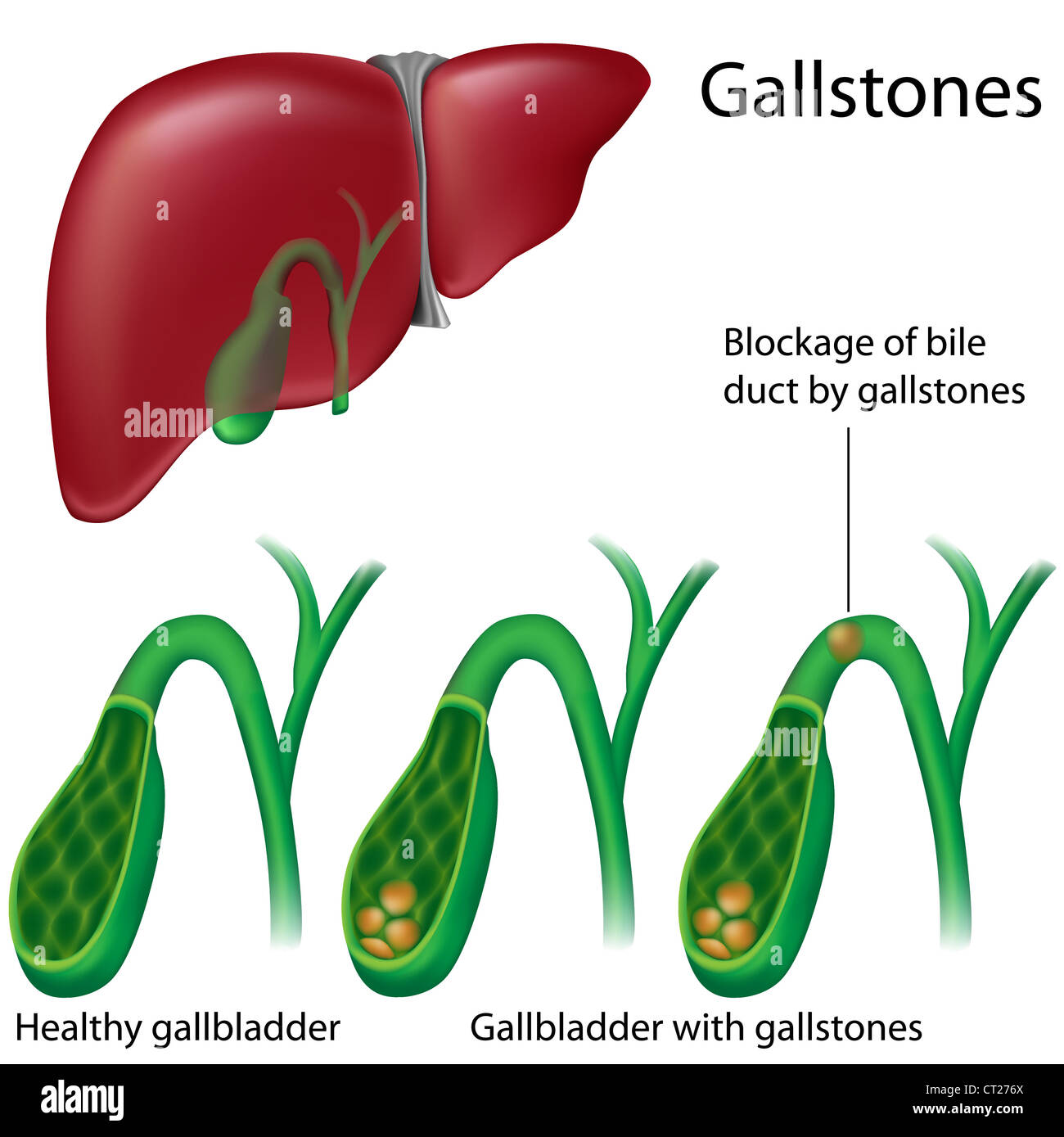Human digestive system cross section hi-res stock photography and ...