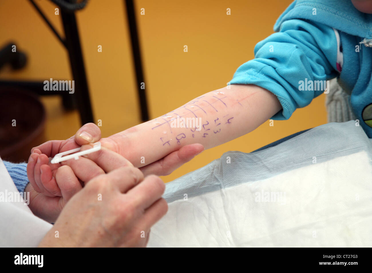 ALLERGY TEST, CHILD Stock Photo - Alamy