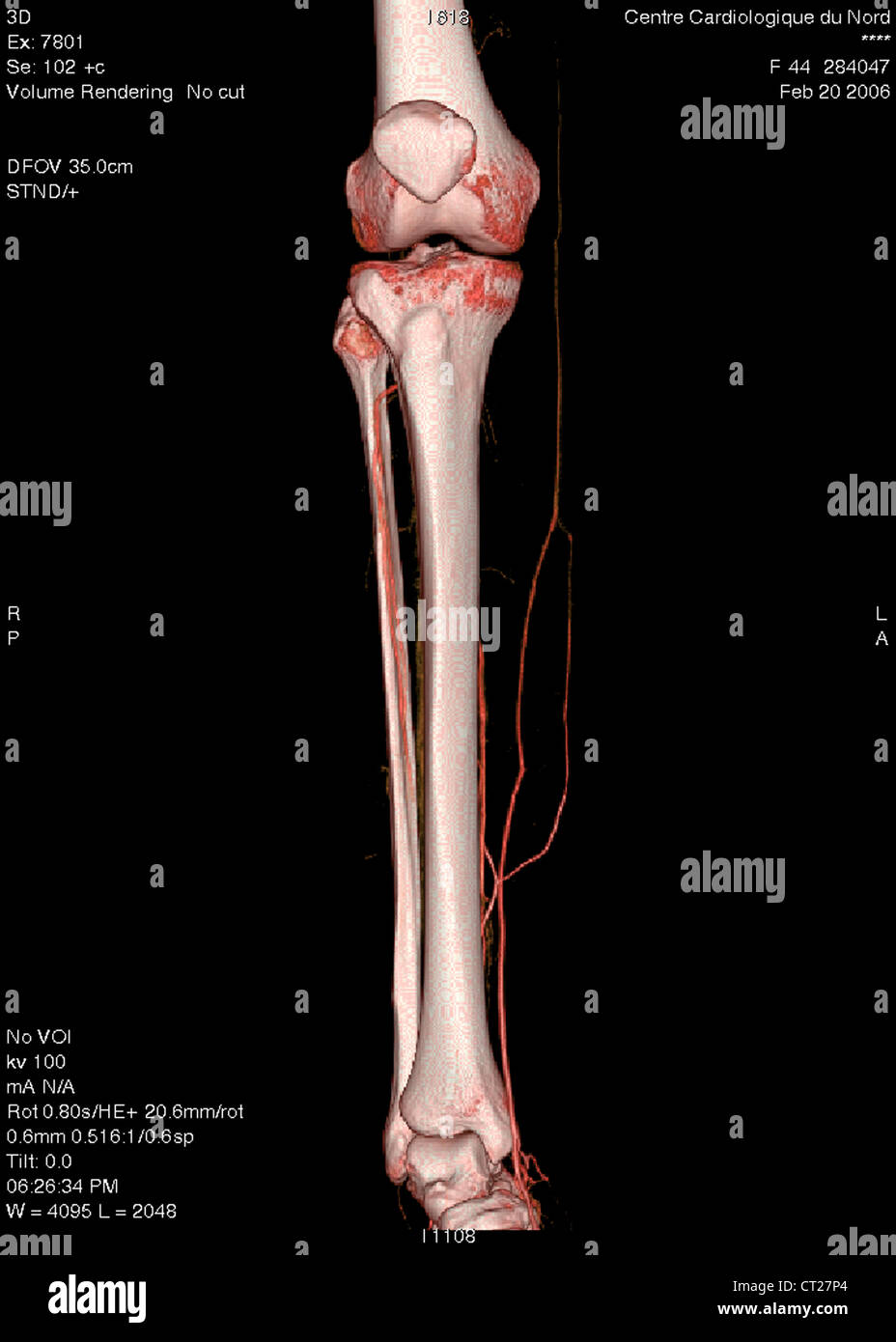 Saphena Stock Photos & Saphena Stock Images - Alamy