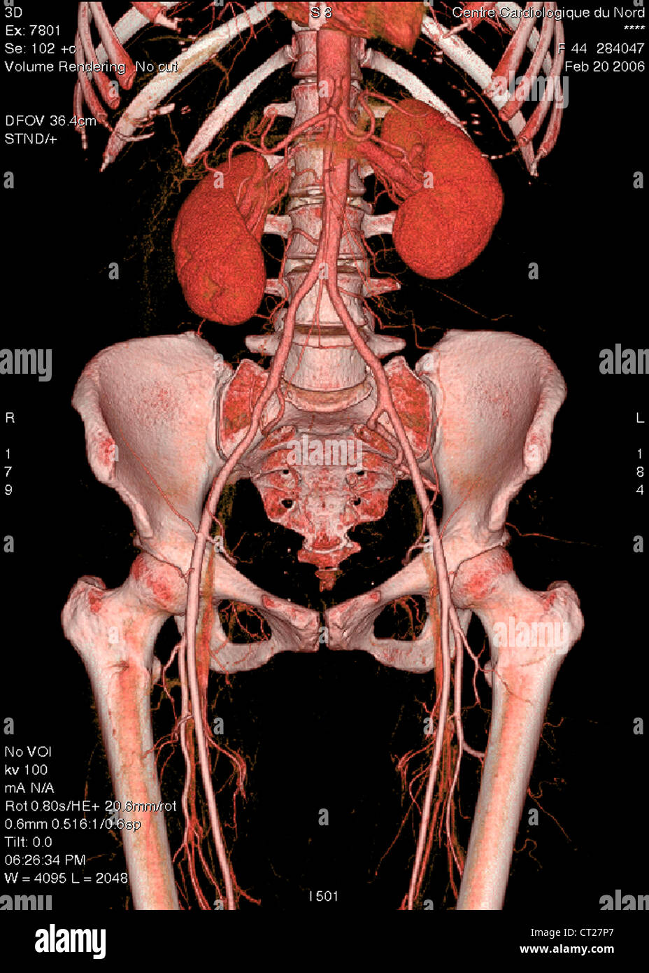 BLOOD CIRCULATION, 3D SCAN Stock Photo - Alamy