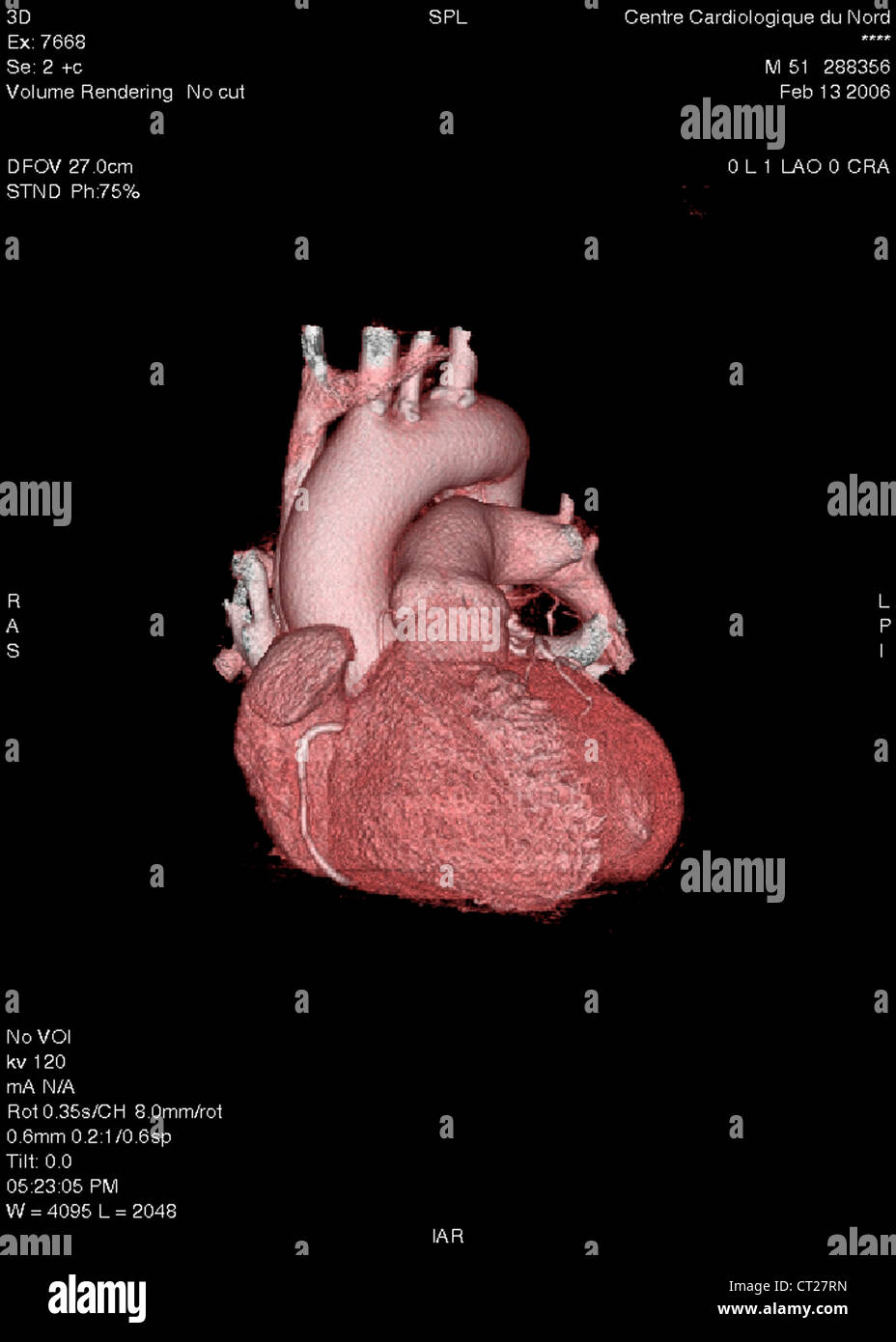 HEART, 3D SCAN Stock Photo - Alamy