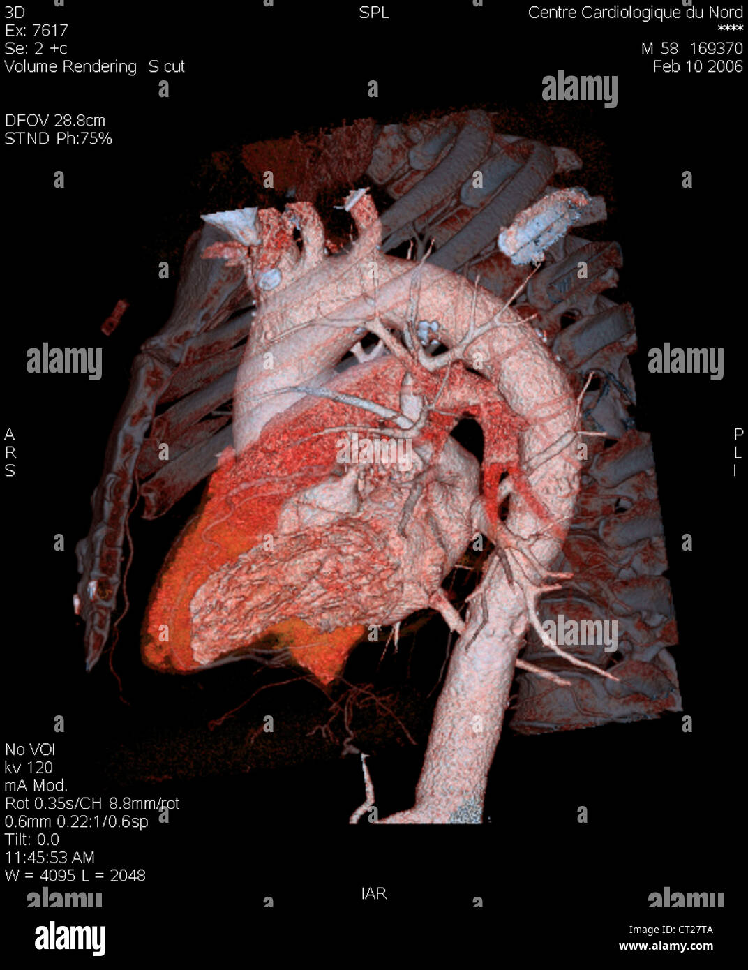 AORTA, 3D SCAN Stock Photo - Alamy