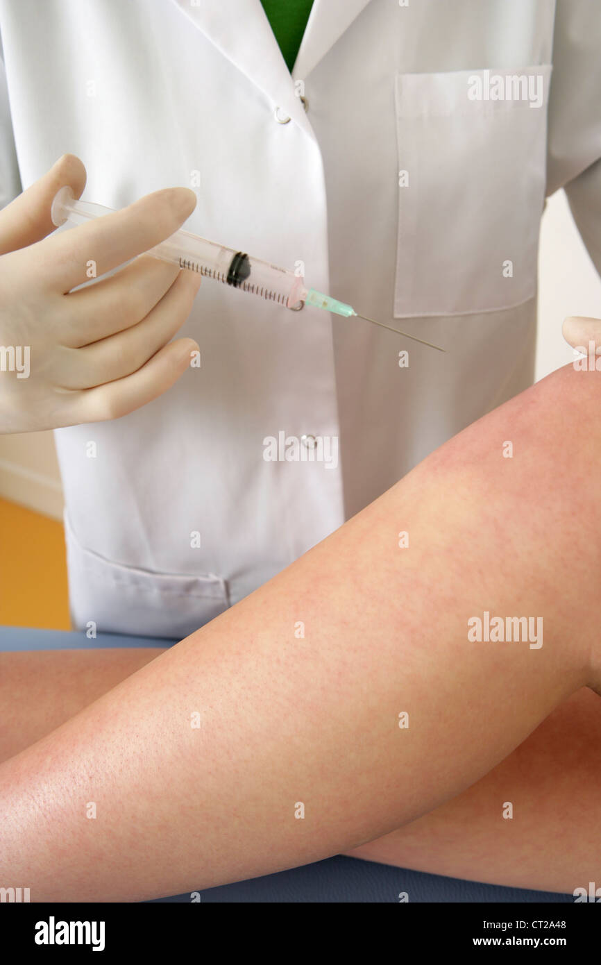 Knee joint injection treatment hi-res stock photography and images - Alamy