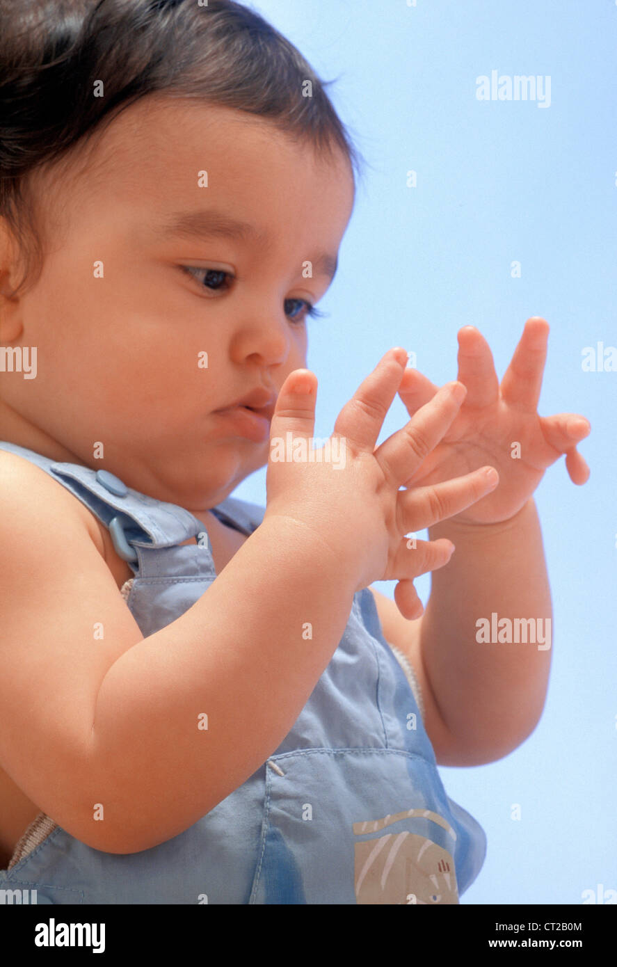 Polydactyly hi-res stock photography and images - Alamy