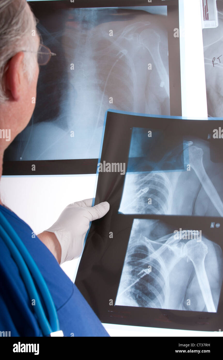 Surgeon studying a pair of x-rays determining a diagnosis of patients ...