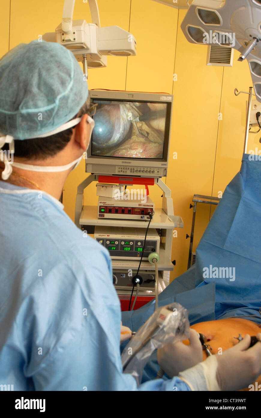 Gallbladder removal hi-res stock photography and images - Alamy