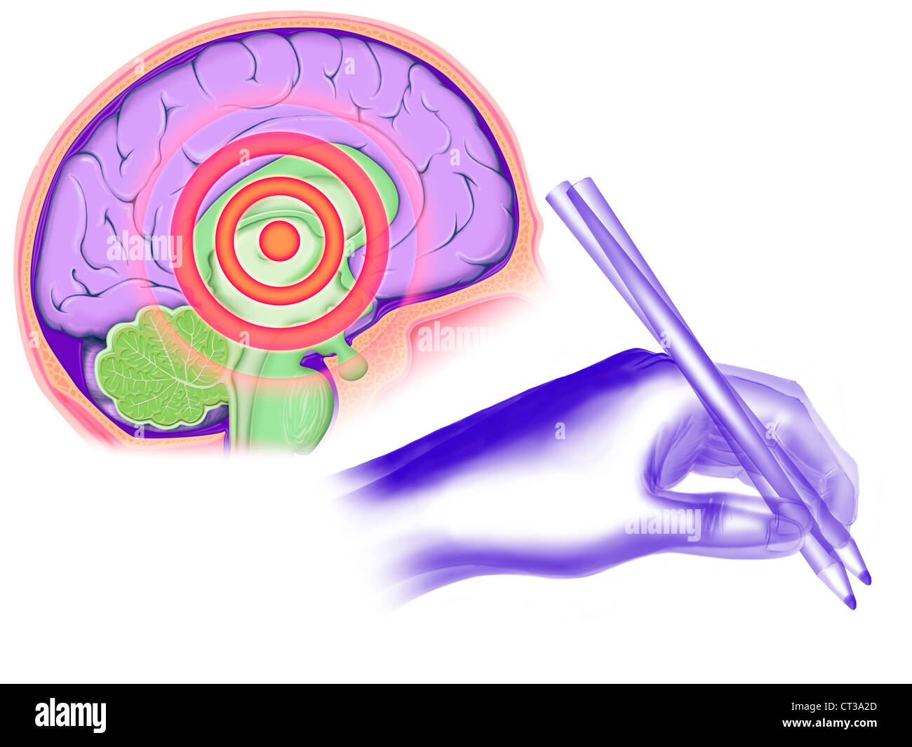 PARKINSON'S DISEASE, DRAWING Stock Photo - Alamy